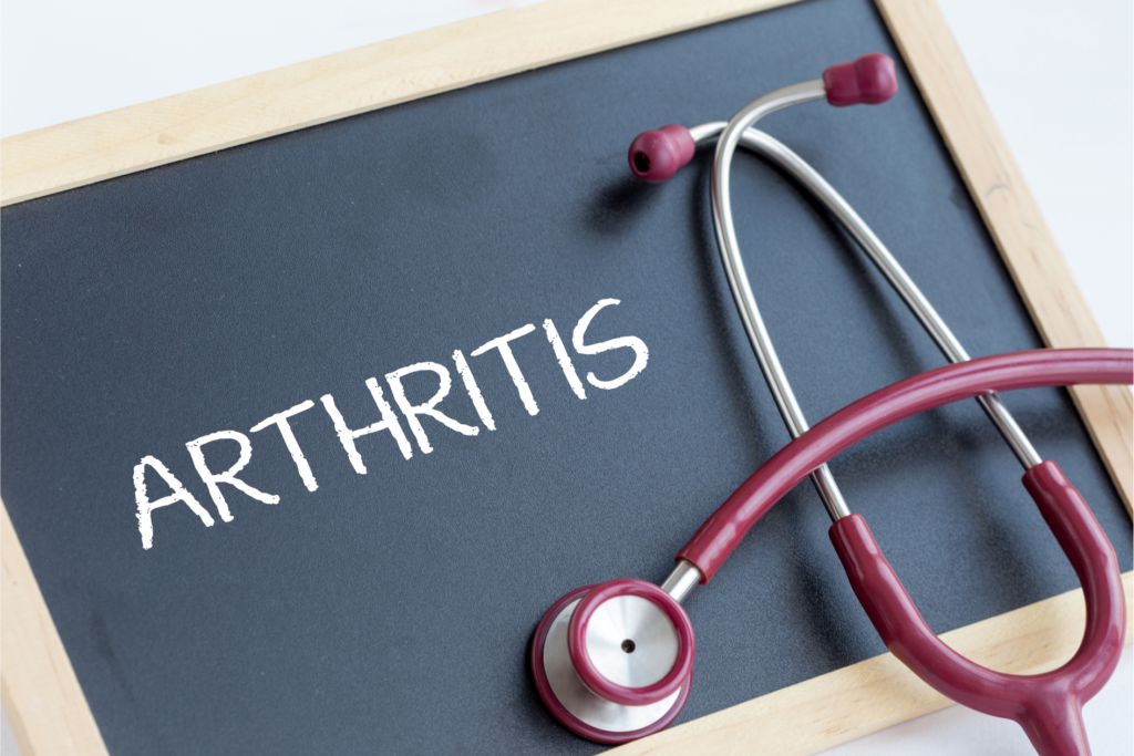 Community Health Resource Center Experts in Arthritis | Community ...